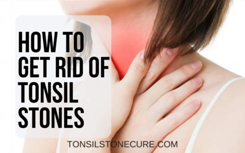 How To Remove Deep, Hidden Tonsil Stones | TonsilStoneCure How To Remove Deep, Hidden Tonsil Stones | TonsilStoneCure